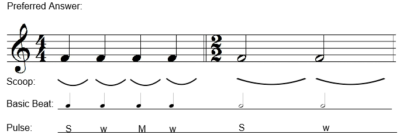 Quadruple or Duple - What is the Time Signature? - Ultimate Music Theory